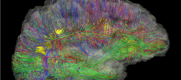 Edinburgh exhibition of striking medical images | The University of ...