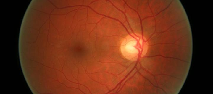 15 Aug 19. Ophthalmic Imaging meeting | The University of Edinburgh