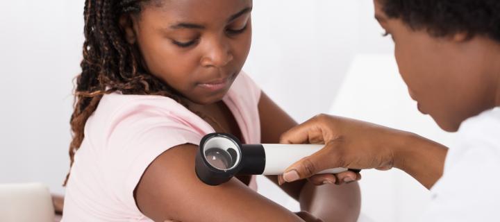 Black children overlooked in tissue disorder tests | The University of ...