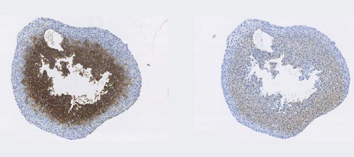 Ian Kunkler | The University of Edinburgh