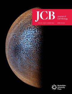 New paper featured on cover of Journal of Cell Biology | The University ...